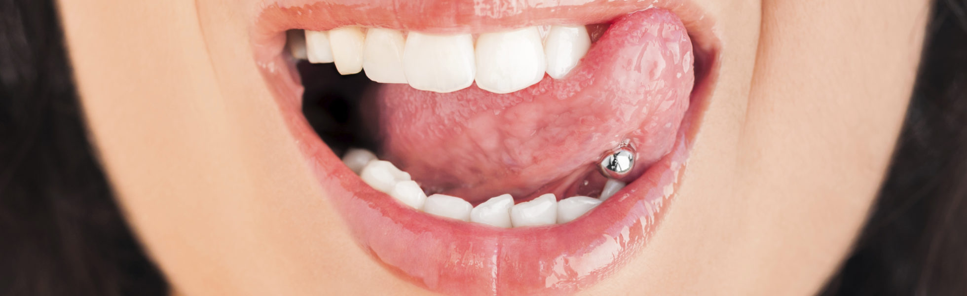 Oral Piercings – Get the Facts First – Burnaby Heights Dental Centre